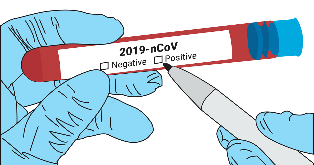 What is Antibody Testing? What Role Is It Playing in the Pandemic?